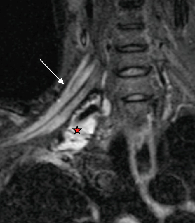Peripheral Nerve Imaging Hawaii Diagnostic Radiology Services By Y M Peripheral Nerve Imaging Hawaii Diagnostic Radiology Services By Y M
